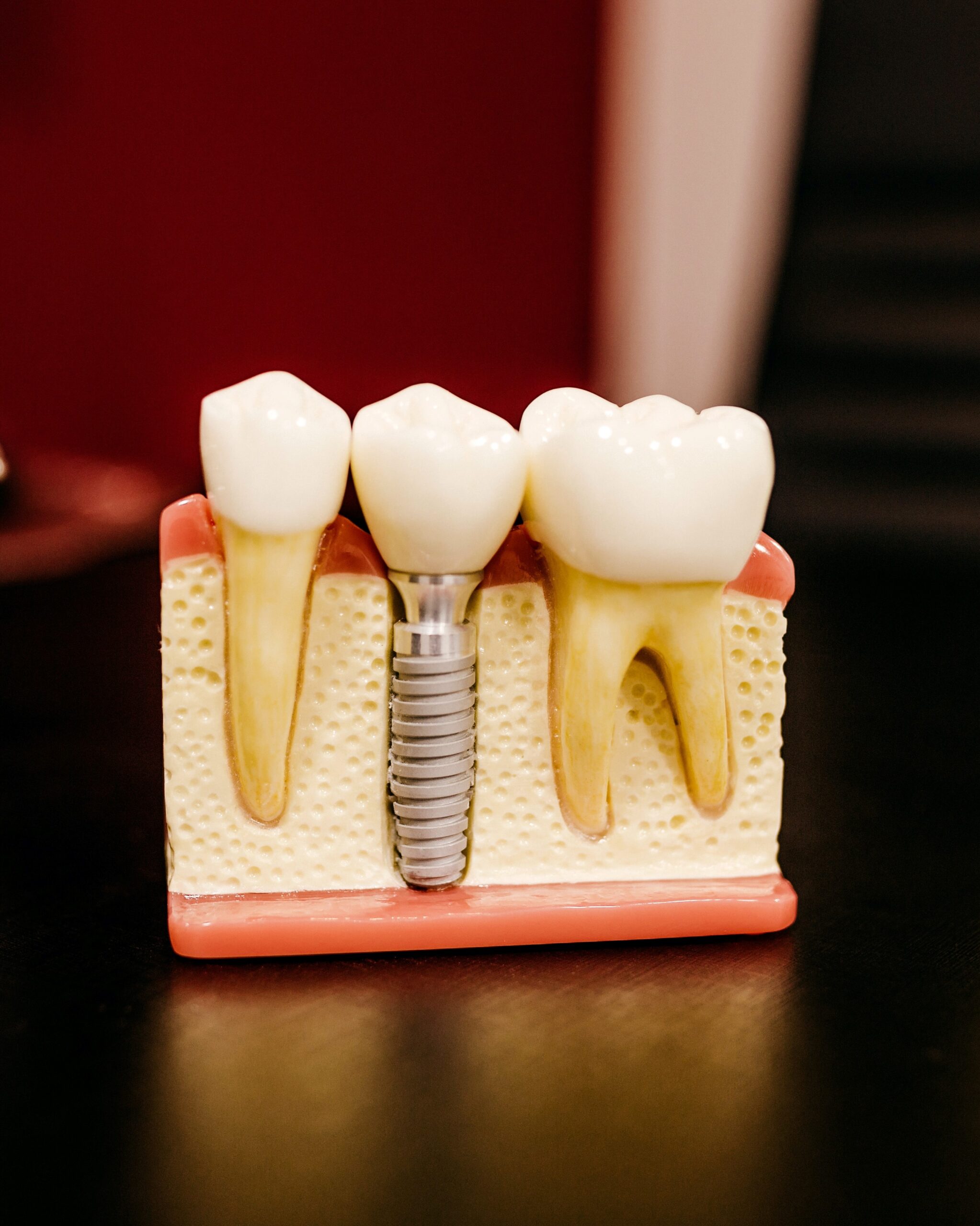 ΕΜΦΥΤΕΥΜΑΤΑ – Οδοντιατρική Κλινική Άντζελας Ντούνη